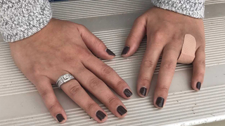 Woman Loses Finger When Wedding Ring Gets Caught On Fence - NewsChannel ...